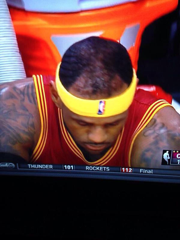 Photo: LeBron James' Hairline Is Looking Really Bad In This Picture